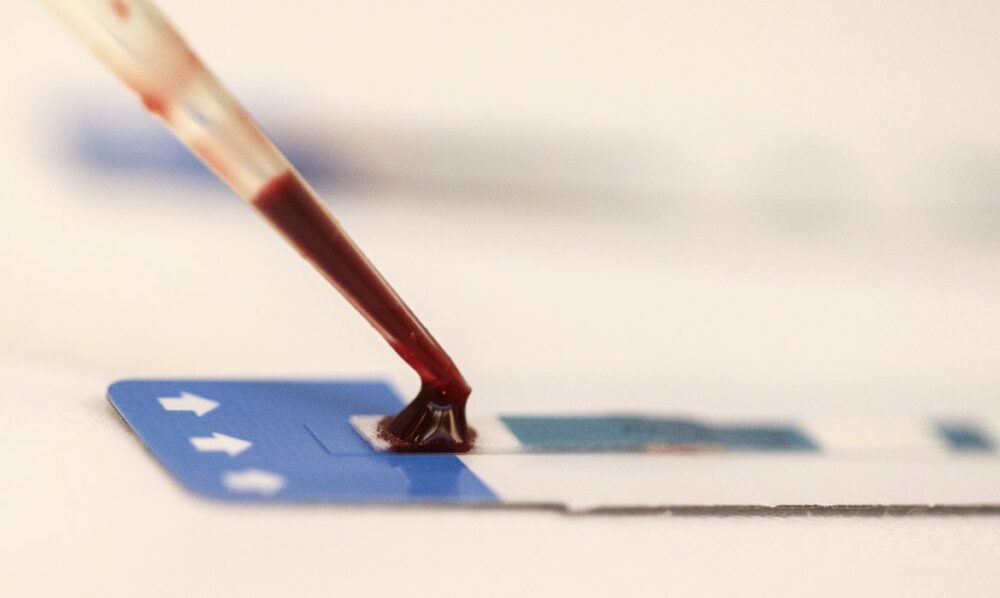 PCDT atualizado da Transmissão Vertical para HIV, sífilis e hepatites ...