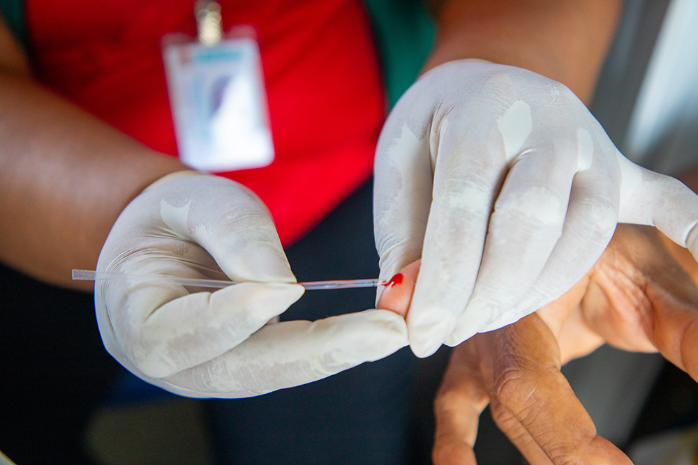 Semsa discute ações de atenção ao HIV/Aids em visitas do Ministério da ...