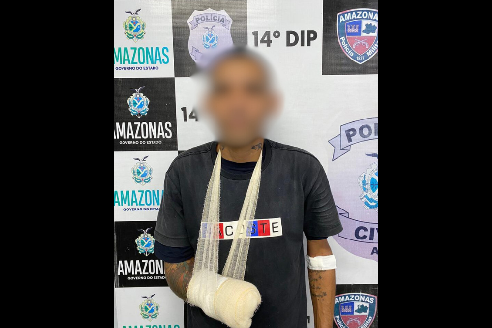 Suposto Assaltante Tem Mão Decepada Pelo ‘tribunal Do Crime No Coroado