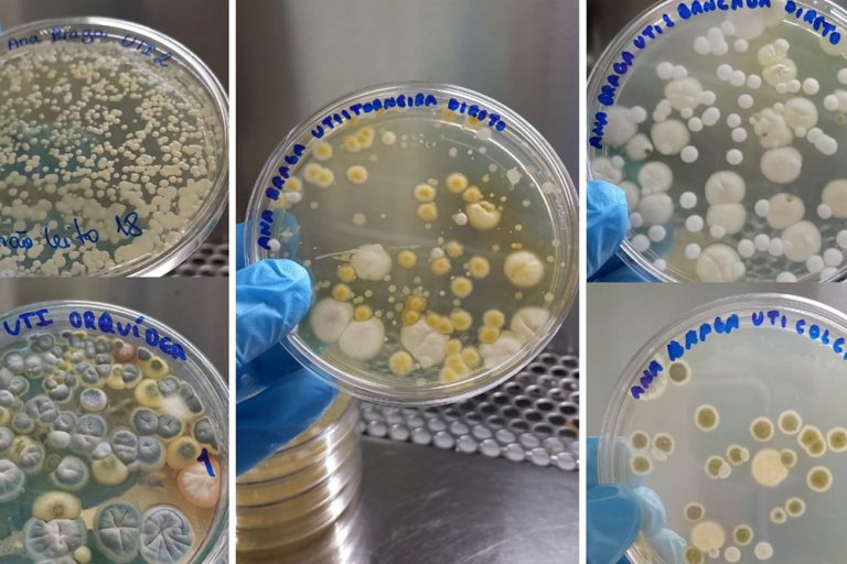 Pesquisa avalia espécies de cândida na rede de esgoto hospitalar ...